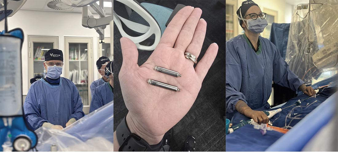 Tiny Pacemaker Marks Big Breakthrough For Sa Heart Care